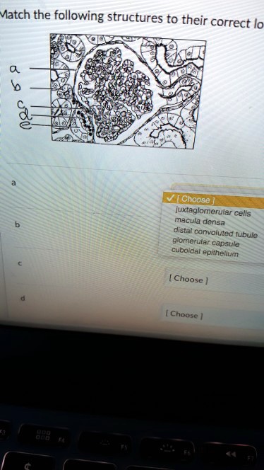 Match the following structures to their correct lo a b c d ?[Choose] juxtaglomerular cells ...