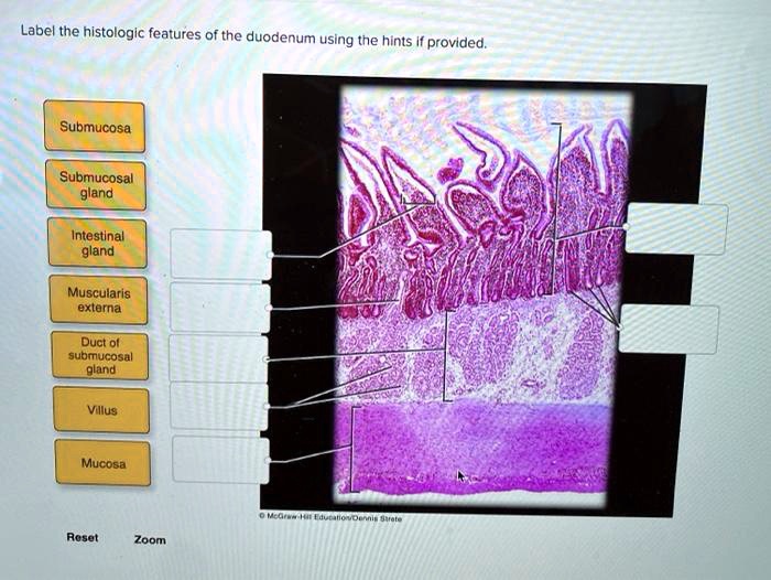 Label the histologic features of the duodenum using the hints if provided. Submucosa Submucosal ...