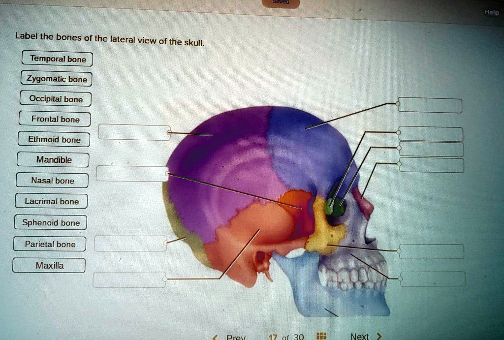 Label The Bones Of The Lateral View Of The Skull Temporal Bone