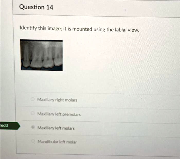 dental Question 14 Identify this image; it is mounted using the labial ...