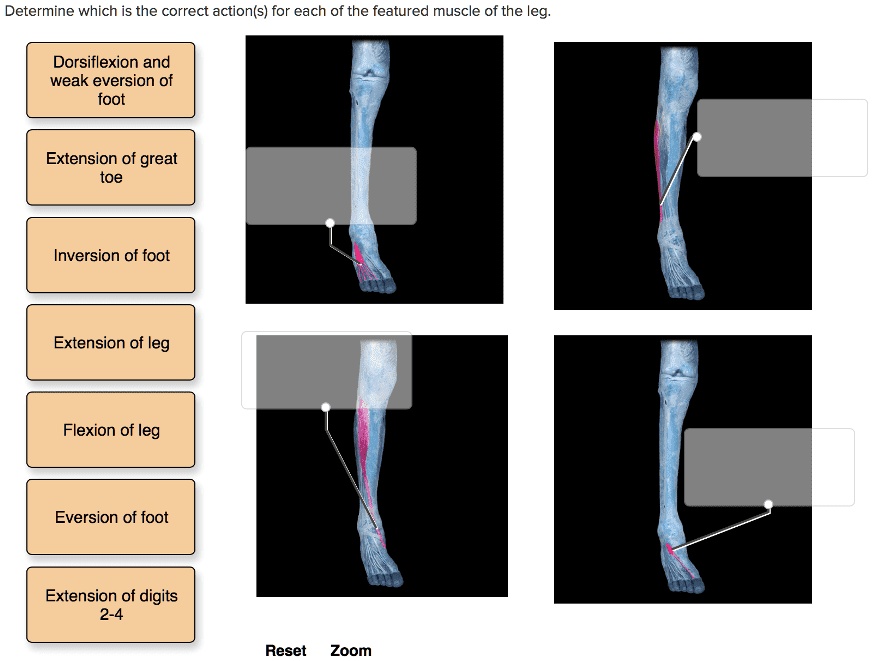 SOLVED: ' Determine which is the correct action(s) for each of the ...