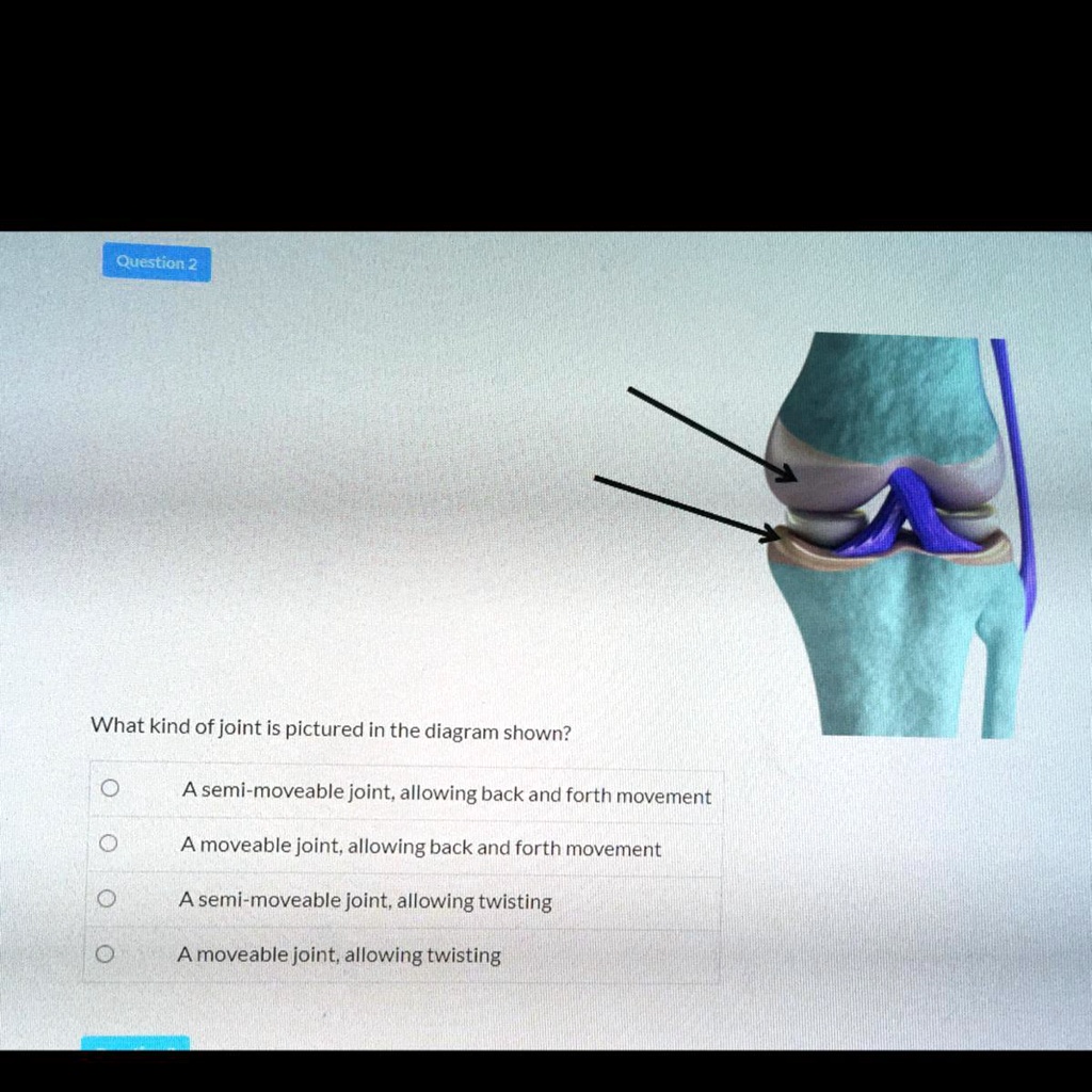 [GET ANSWER] Question 2 What kind of joint is pictured in the diagram ...