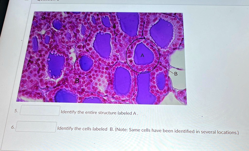 SOLVED: Identify the entire structure labeled A. Identify the cells ...