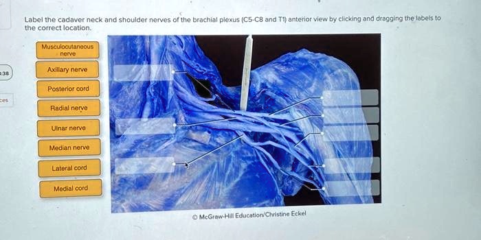 Solved Texts Label The Cadaver Neck And Shoulder Nerves Of The