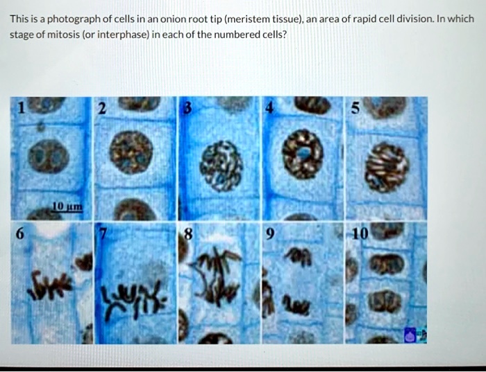 SOLVED: This is a photograph of cells in an onion root tip (meristem ...