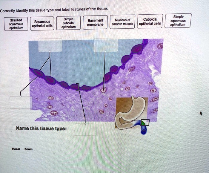 SOLVED: Correctly Identify this tssue type and label features of the tissue. Stratifod Simple ...