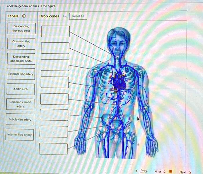 Label the general arteries in the figure. Labels Descending thoracic ...