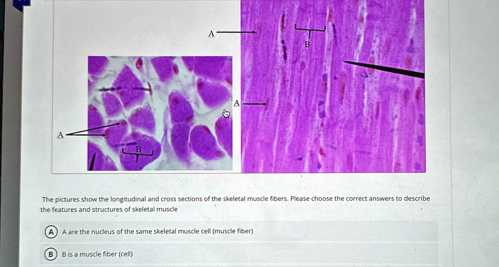 A B A B A The pictures show the longitudinal and cross sections of the ...