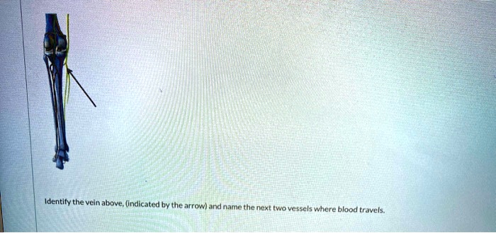 SOLVED: Identify the vein above (indicated by the arrow) and name the next two vessels where ...