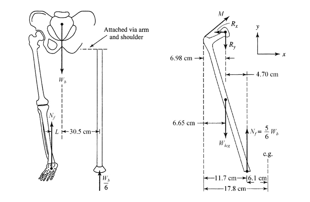 Consider the forces on the body when standing on one leg, partially ...