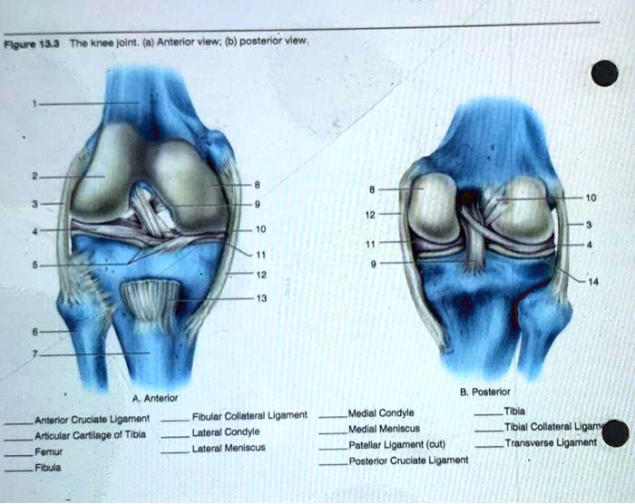 SOLVED: Figure 13.3 The knee joint. a. Anterior view b. Posterior view ...