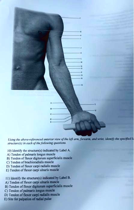 SOLVED: Texts: Please label the whole figure. Using the above-referenced anterior view of the ...