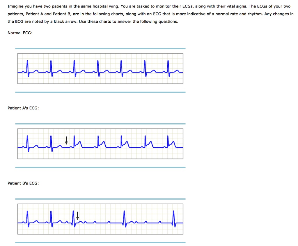 SOLVED: Q1. Which of the following best describes the changes seen in Patient B's ECG? Check all ...