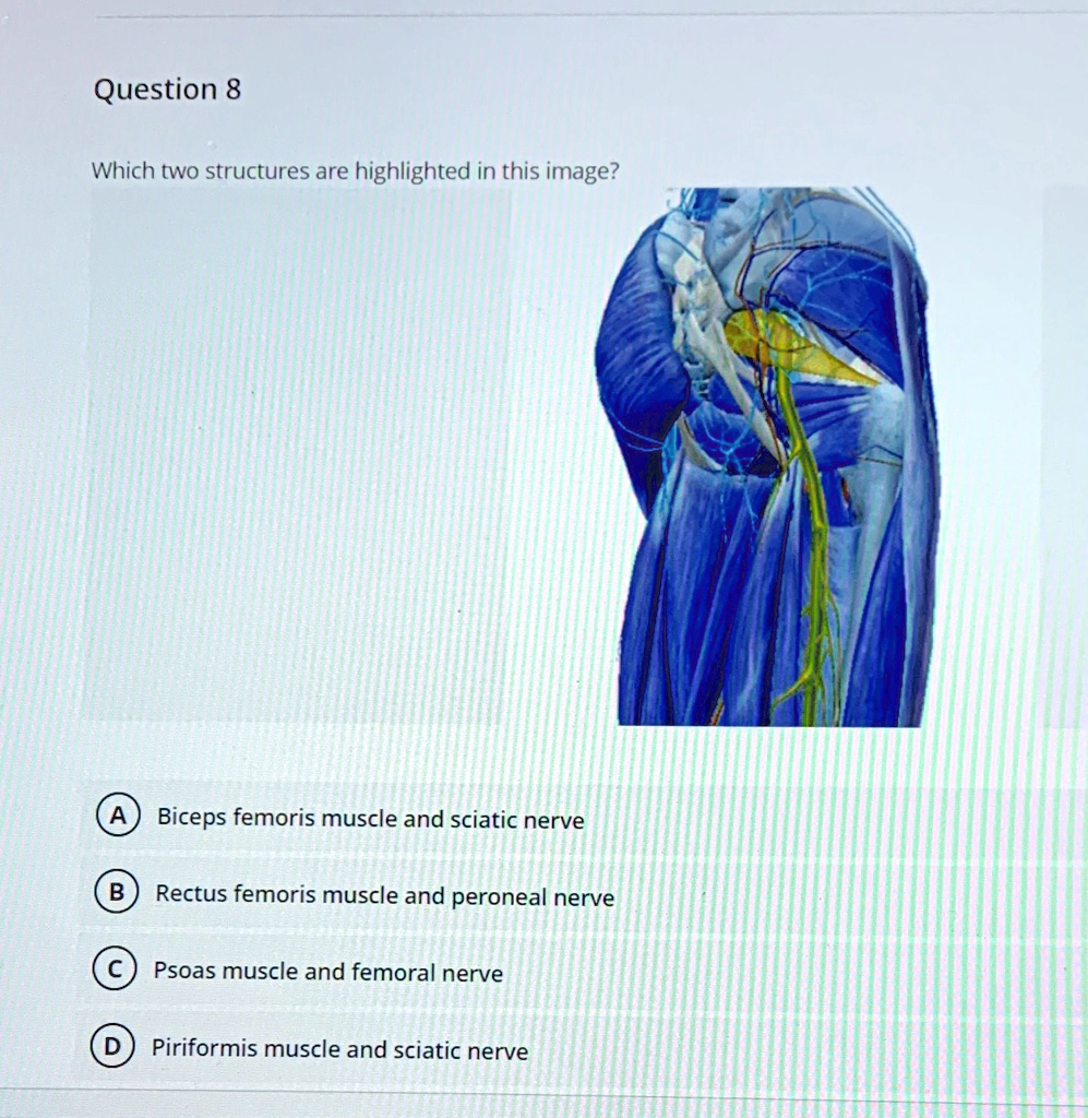 question 8 which two structures are highlighted in this image biceps ...