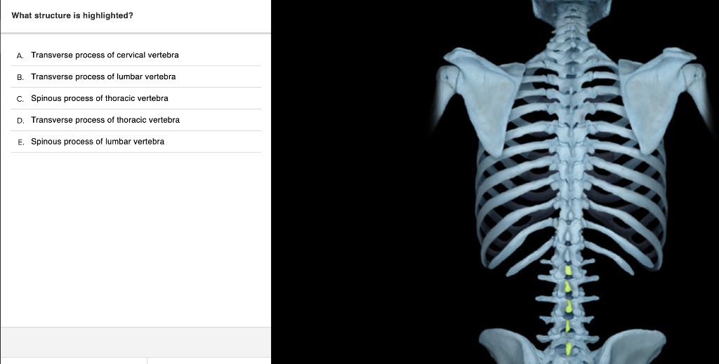 What structure is highlighted? A. Transverse process of cervical ...