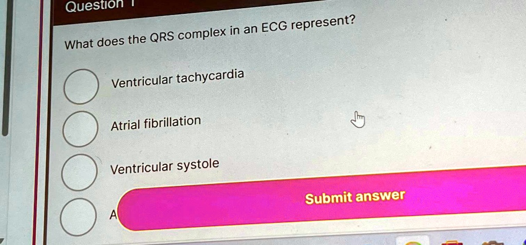 Question I What does the QRS complex in an ECG represent? Ventricular ...