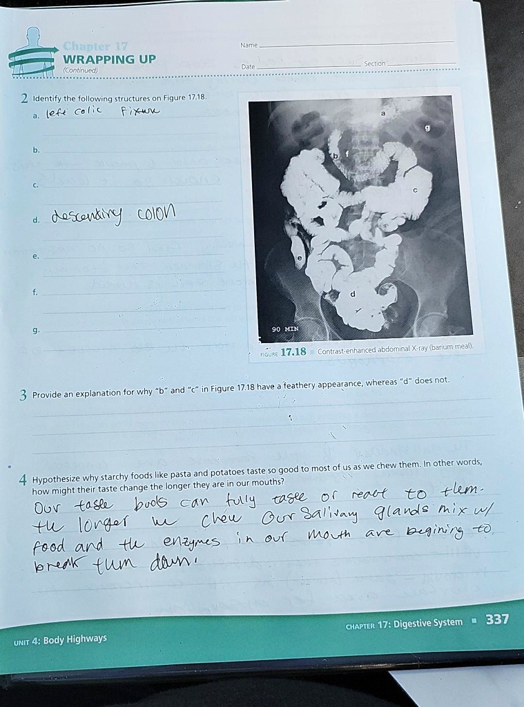 SOLVED: questions 2 and 3 Chapter l7 WRAPPING UP (Continued 2 Identify the following structures ...
