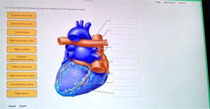 Correctly label the following external anatomy of the posterior heart. Superior vena cava Left ...