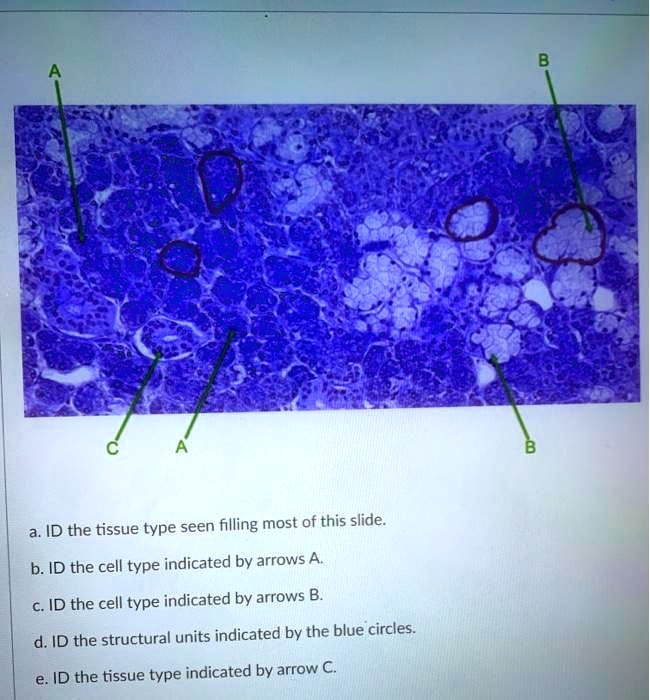 A id the tissue type seen filling most of this slide b id...