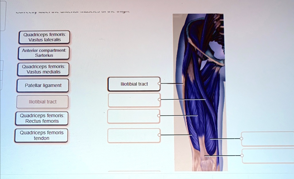 Quadriceps femoris: Vastus lateralis Anterior compartment: Sartorius ...