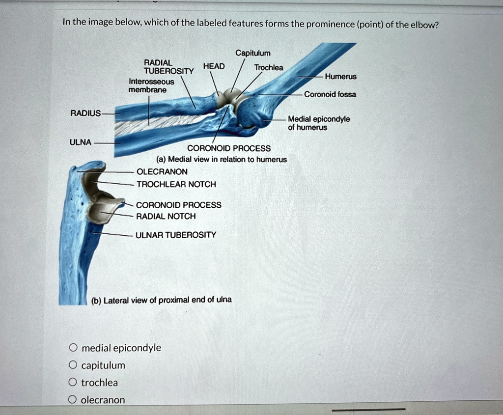 In the image below, which of the labeled features forms the prominence ...