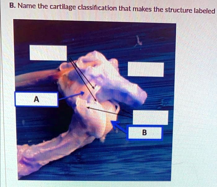 name the cartilage classification that makes up the structure labeled B ...
