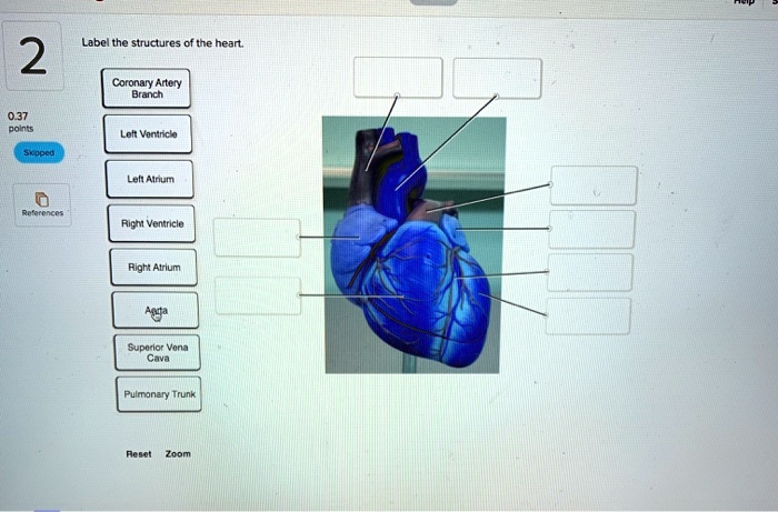 SOLVED: Label the structures of the heart. 2. Coronary Artery Branch 0. ...