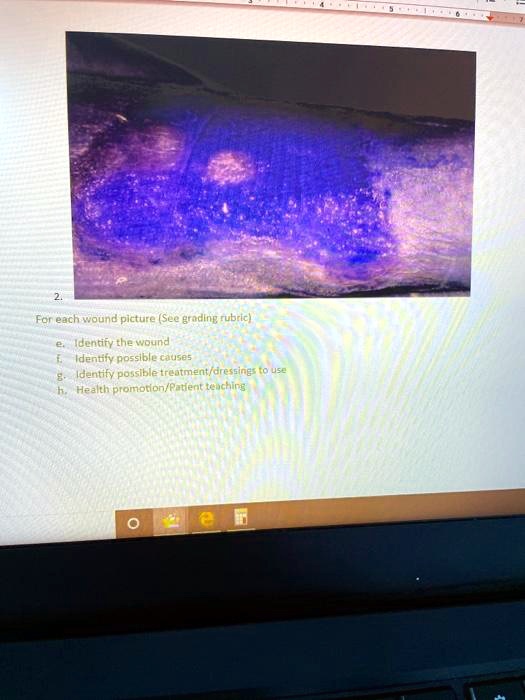 SOLVED: For each wound picture (See grading rubric): f. - Identify possible causes g. - Identify ...