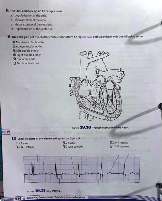 SOLVED: The QRS complex on an ECG represents: a. depolarization of the ...
