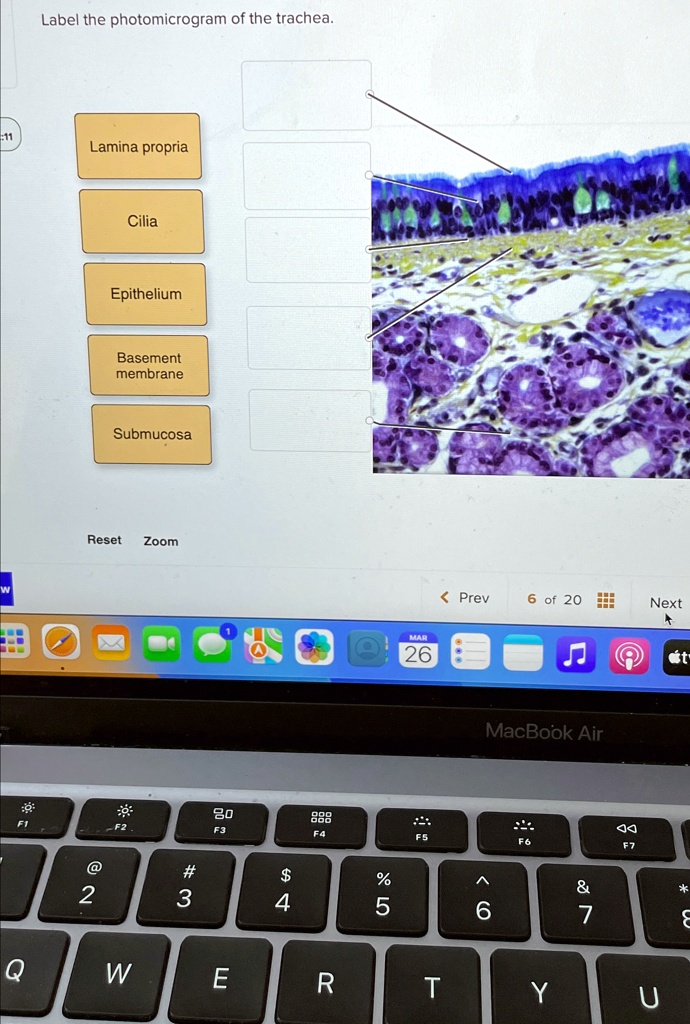 Label the photomicrogram of the trachea. Lamina propria Cilia ...