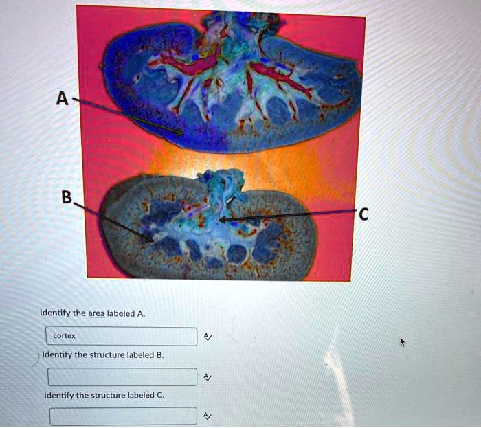 SOLVED: A Identify the area labcled cottex Identify the structure labeled B. Identify the ...