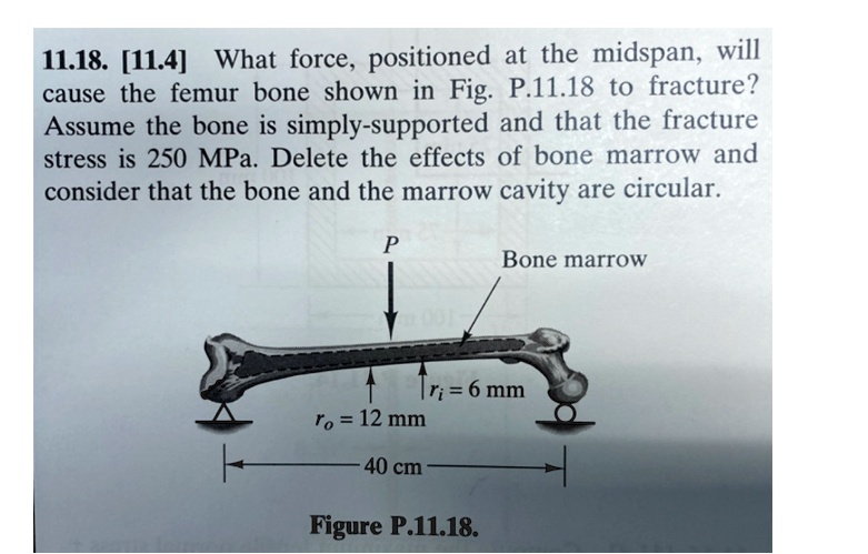 1118 114 what force positioned at the midspan will cause the femur bone ...