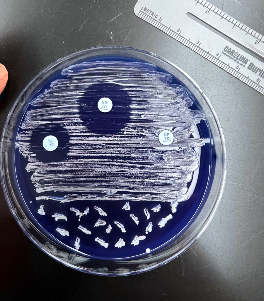 identify the unknown bacteria from these bacterias bacillus cereus ...