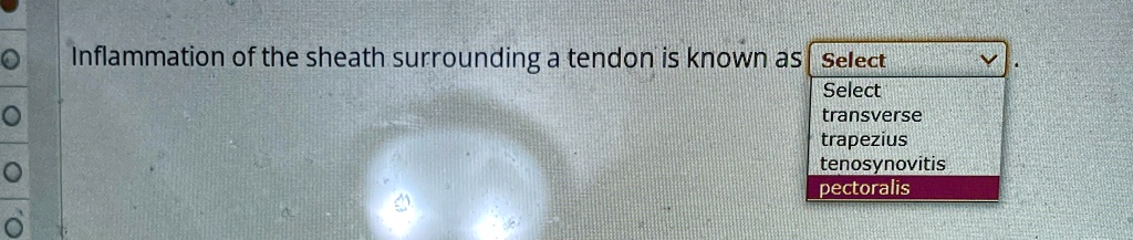 Inflammation of the sheath surrounding a tendon is known as Select ...