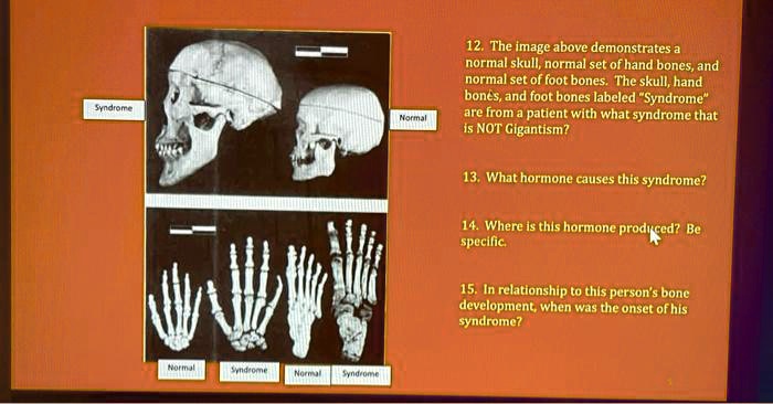 VIDEO solution: 12. The image above demonstrates a normal skull, normal ...