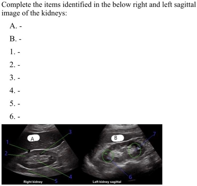 SOLVED: Kidney Complete the items identified in the below right and ...