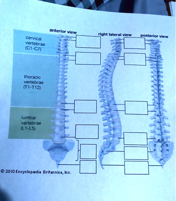 SOLVED: Anterior View Right Lateral View Cervical Vertebrae (C1-C7 ...