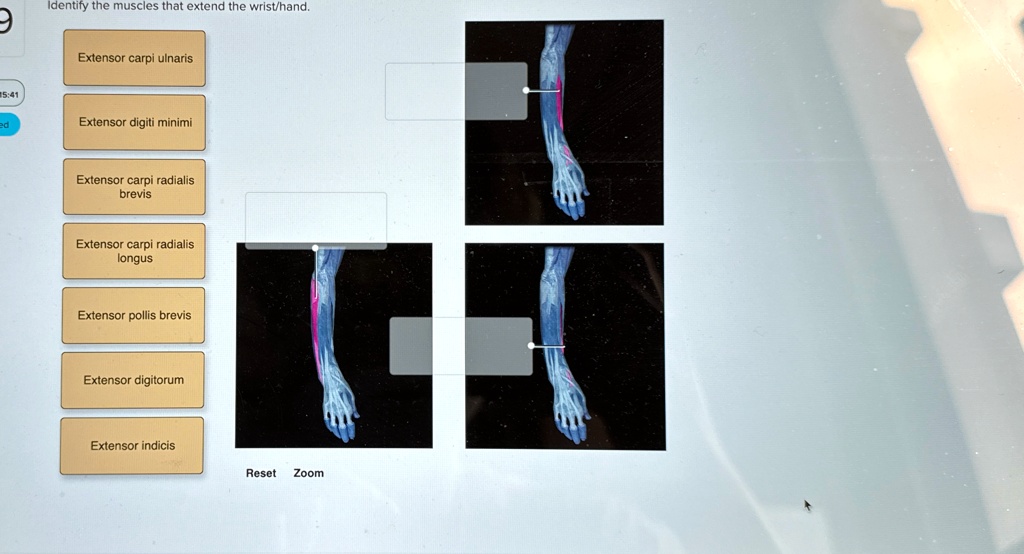 Identify the muscles that extend the wrist/hand. Identify the muscles ...