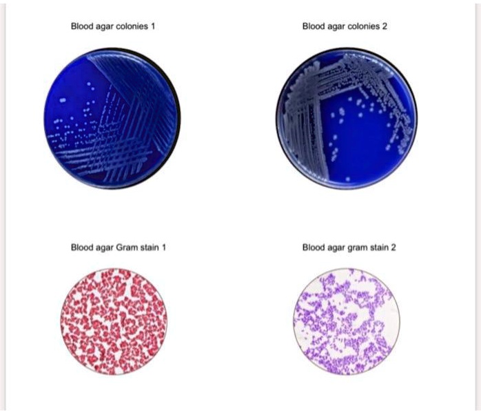 Blood agar colonies 1 Blood agar colonies 2 Blood agar Gram stain 1 Blood agar gram stain 2