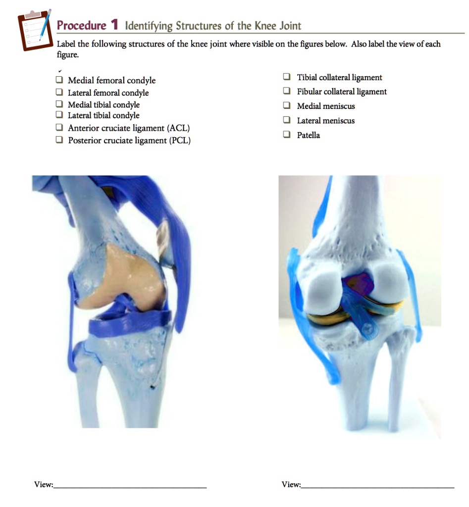 SOLVED: Procedure 1 Identifying Structures of the Knee Joint Label the following structures of ...