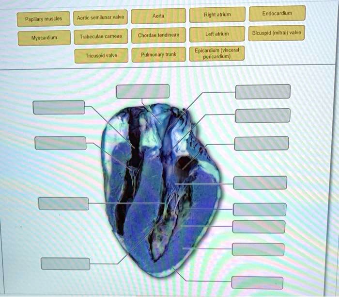 SOLVED: Aortic semilunar valve Aorta Right atrium Endocardium Papillary ...