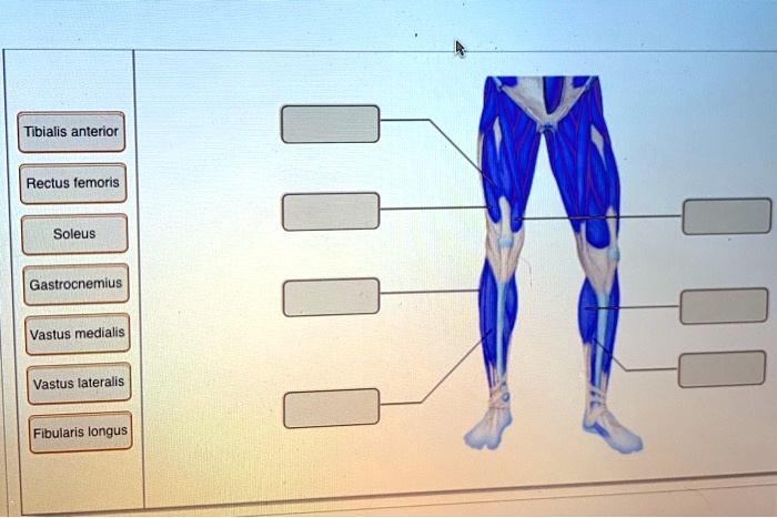 SOLVED: Tibialis anterior Rectus femoris Soleus Gastrocnemius Vastus ...