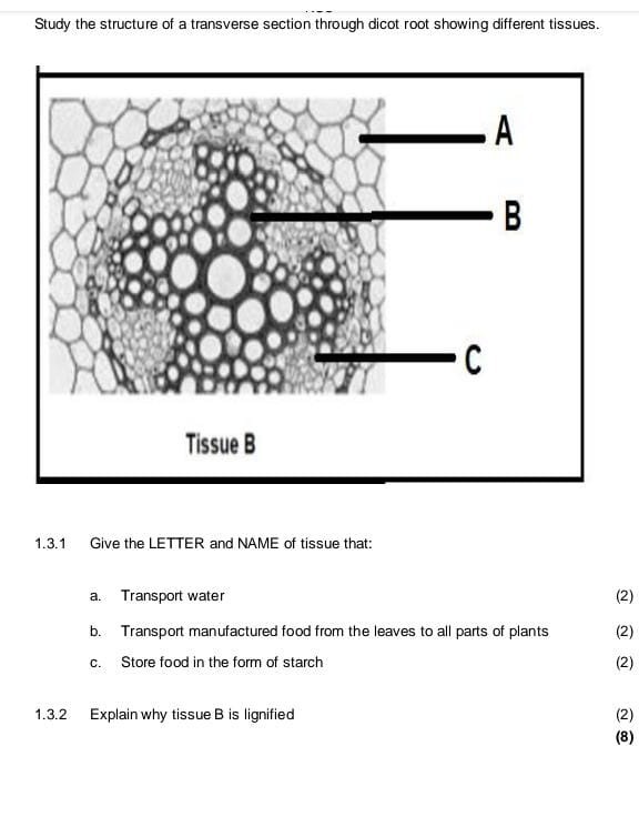 Study the structure of a transverse section through dicot root showing ...
