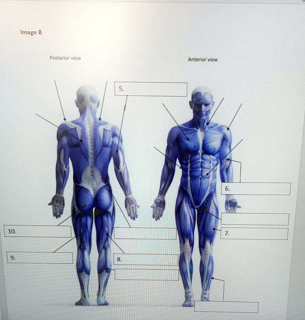 SOLVED: 'please label diagram Image B Posterior view Anterior view 10' SOLVED: 'please label diagram Image B Posterior view Anterior view 10'