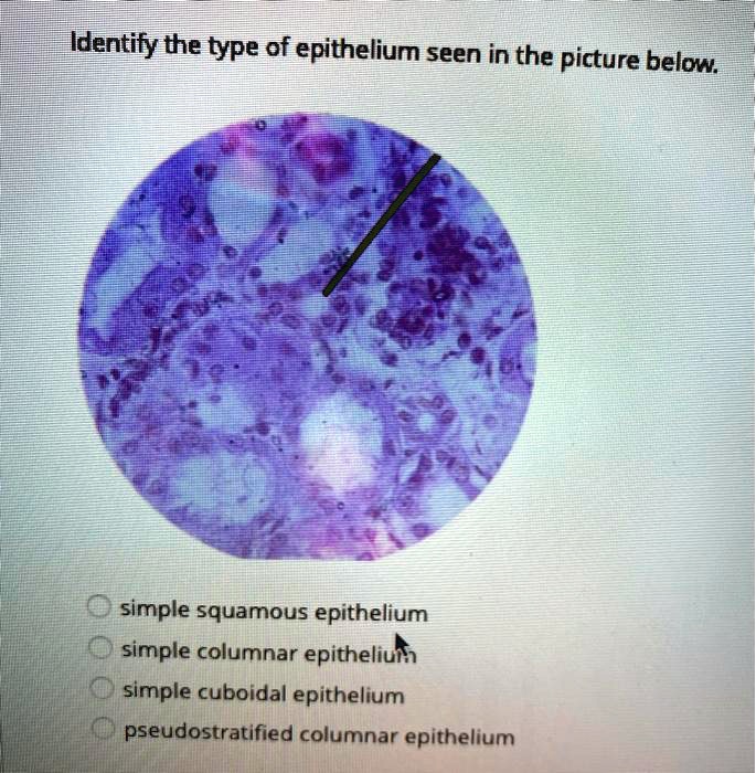 SOLVED: Identify the type of epithelium seen in the picture below ... SOLVED: Identify the type of epithelium seen in the picture below ...