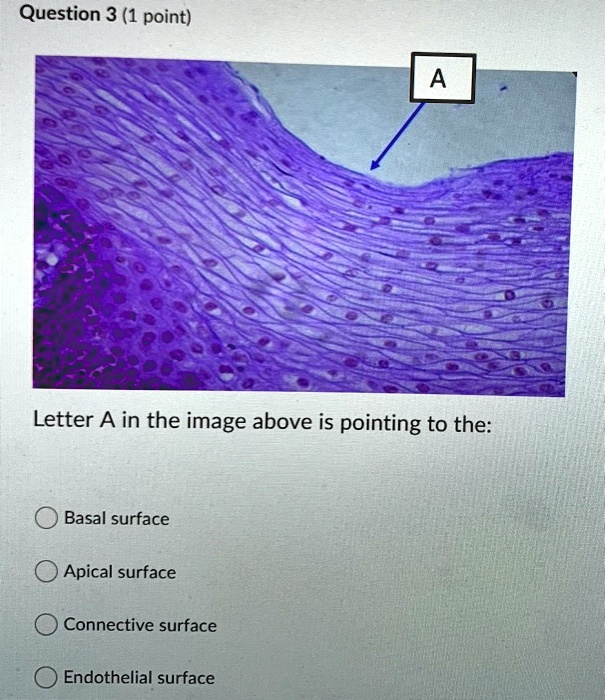 SOLVED: Question 3 (1 point) A Letter A in the image above is pointing ...