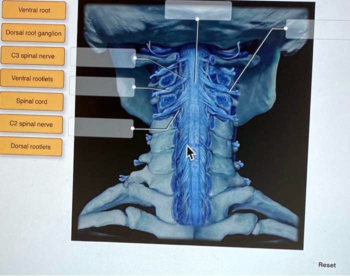 SOLVED: Ventral root Dorsal root ganglion C3 spinal nerve Ventral ...