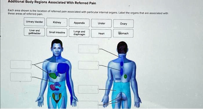 SOLVED: Additional Body Regions Associated With Referred Pain These ...