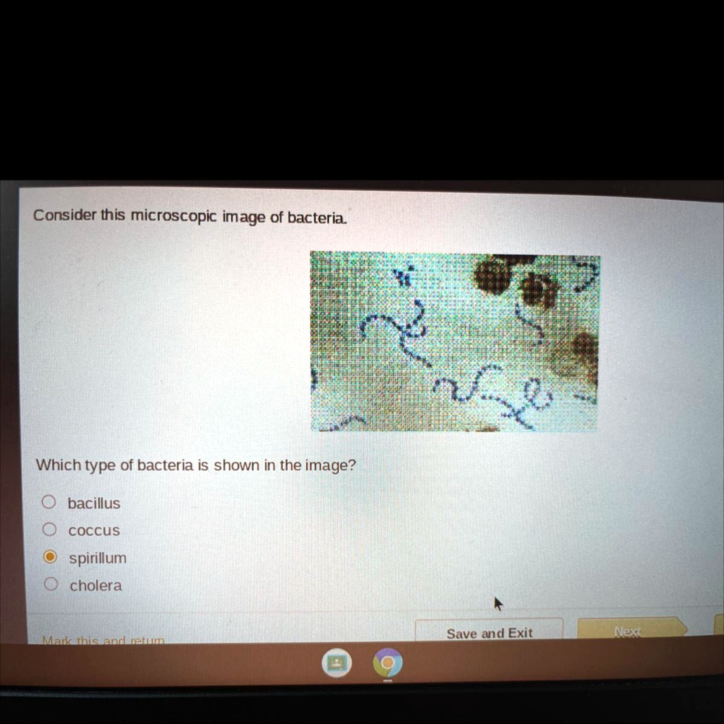 [GET ANSWER] Consider this microscopic image of bacteria. Which type of ...