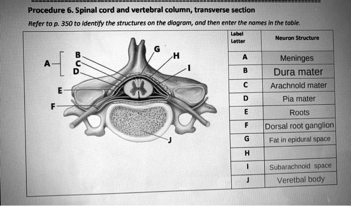 Procedure 6. Spinal cord and vertebral column, transverse section Refer ...